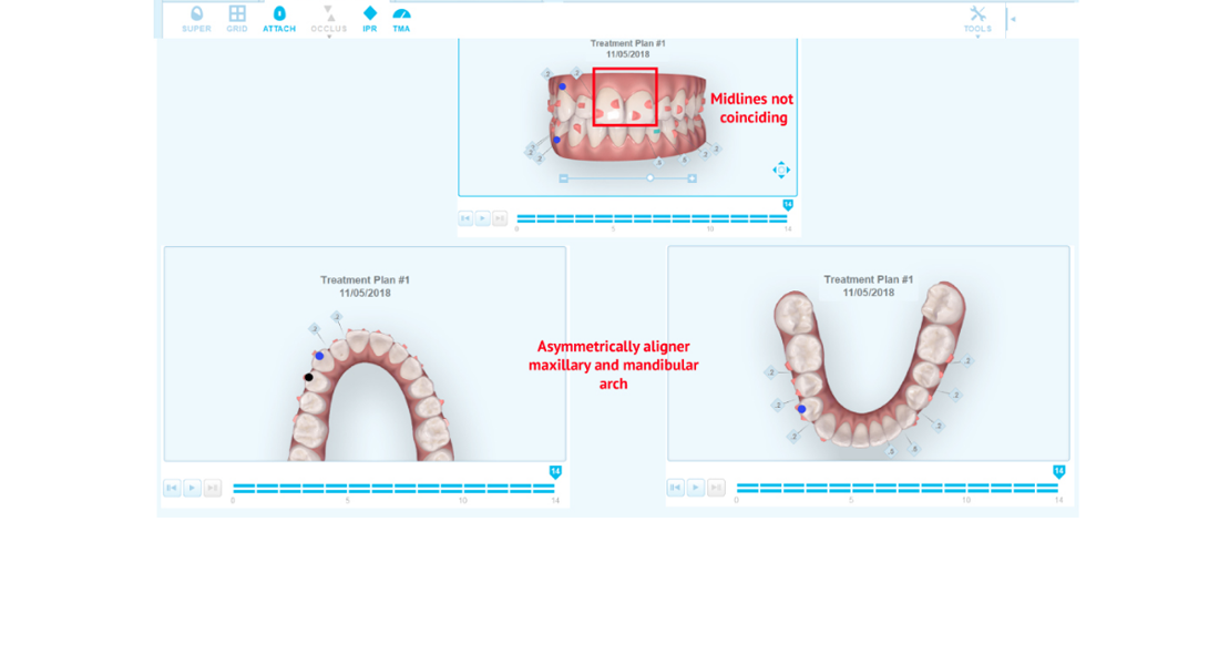 A Brief overview of our review (Case modification: why and how ...