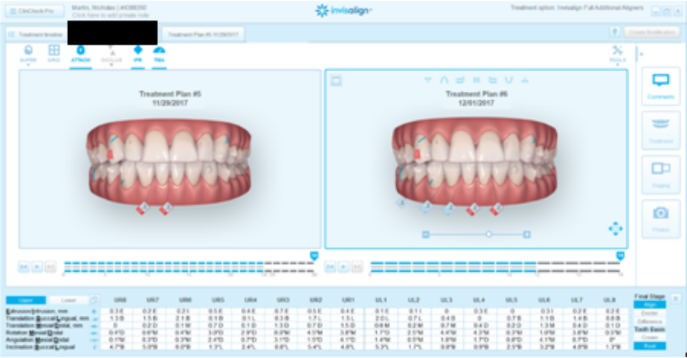 Clincheck's Reviewed by an orthodontist through Aligner Concierege ...