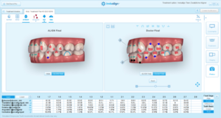 A standard approach of Treating Deep Bites using Aligners | Aligner ...